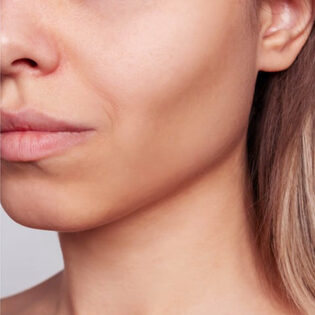Buccal Fat or Cheek Surgery- Dr. Abedini